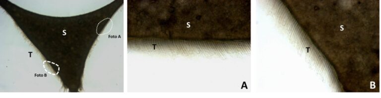 Clinical Protocol for Application of Pit and Fissure Sealant - FGM ...