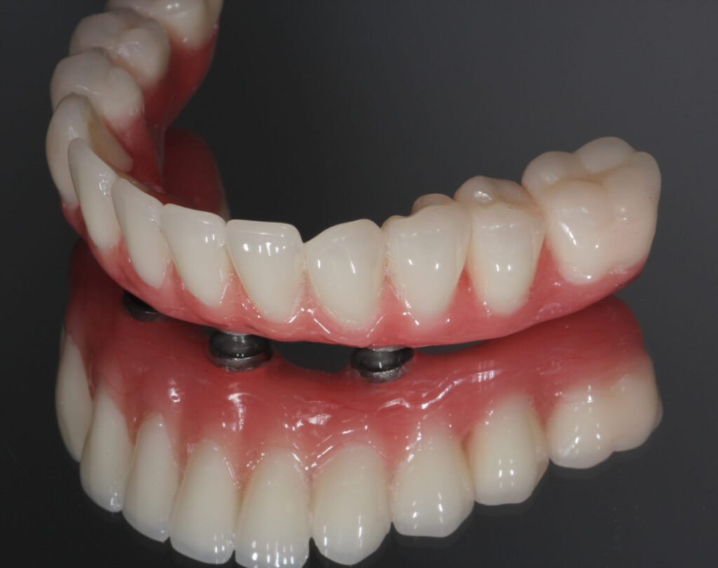 Prótese Dentária: Um Guia Completo - FGM Dental Group