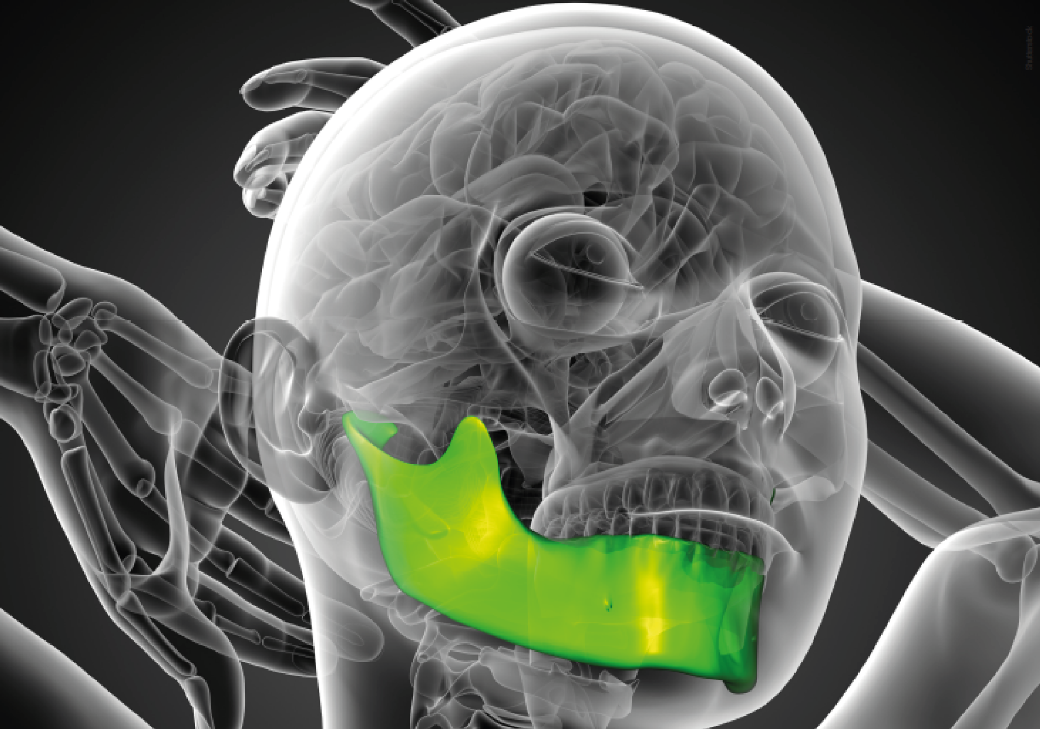 TMJ Disorders: Diagnosis, Treatment, and Scientific Advances - FGM ...