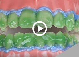 Passo a Passo Whiteness HP Maxx - FGM Dental Group