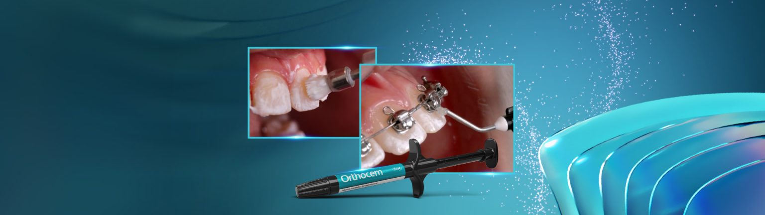 Complementary adhesive devices for orthodontic treatment - FGM Dental Group