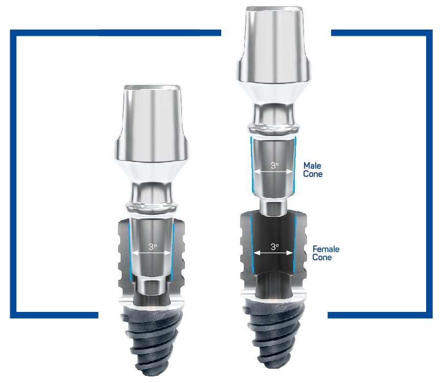 Arcsys System, a stable, reversible and easy-to-use prosthectic ...