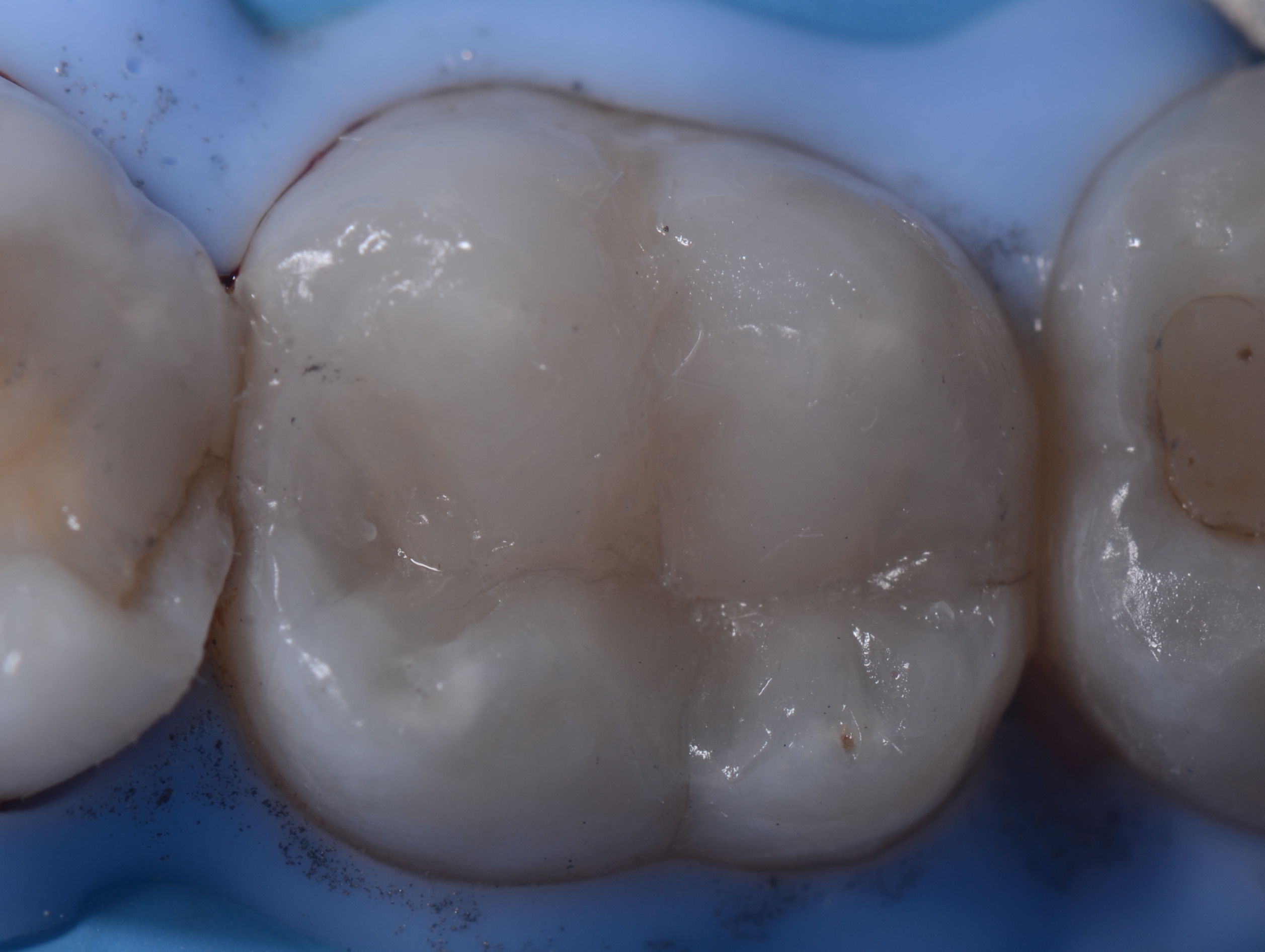 Use Of Vittra Aps Unique Universal Chroma Composite To Replace An ...