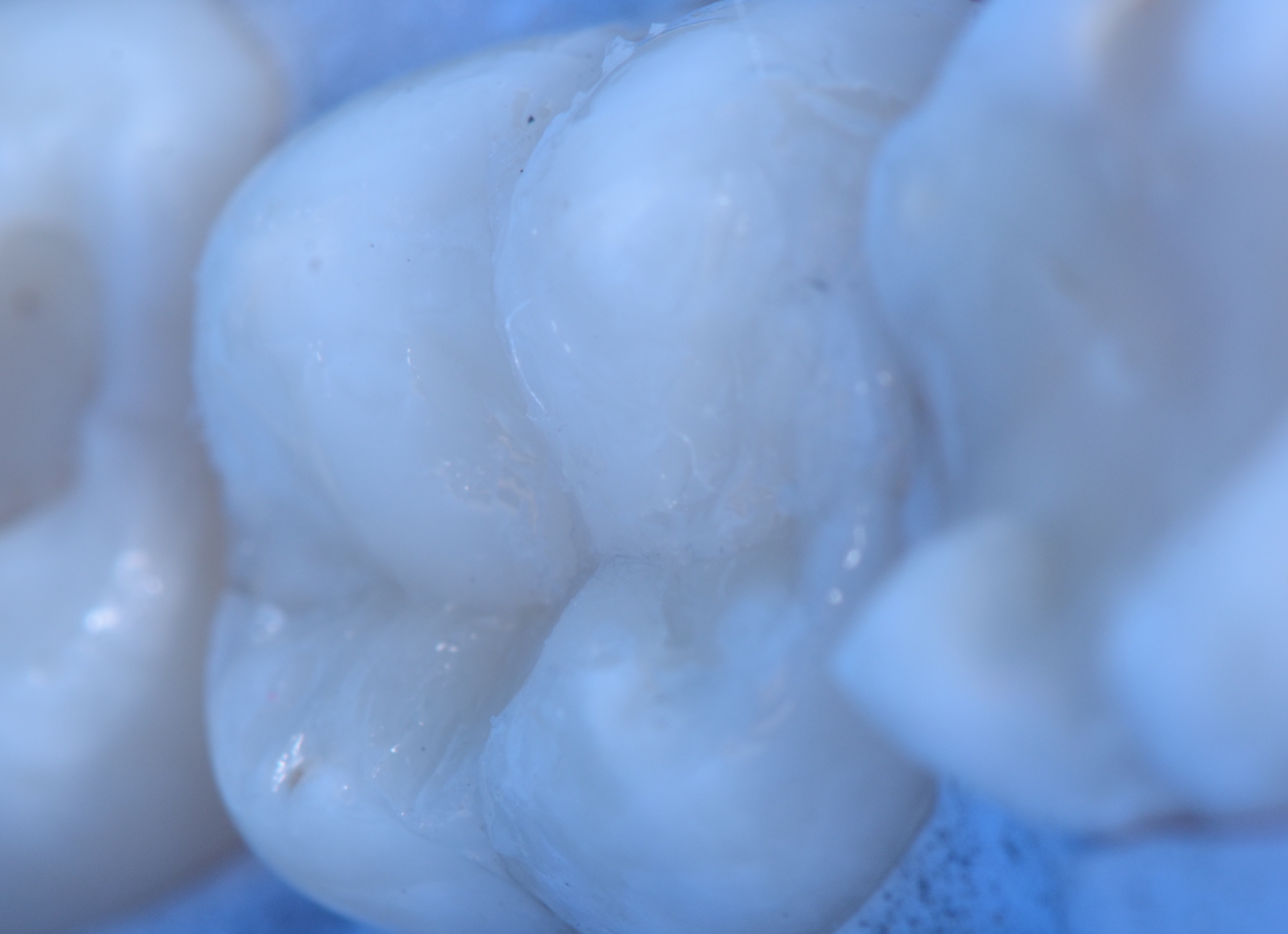 Use Of Vittra Aps Unique Universal Chroma Composite To Replace An ...