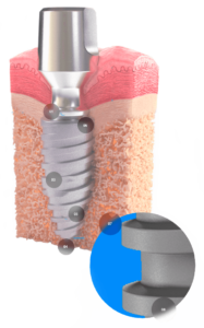 Arcsys Implant System | FGM Dental Group
