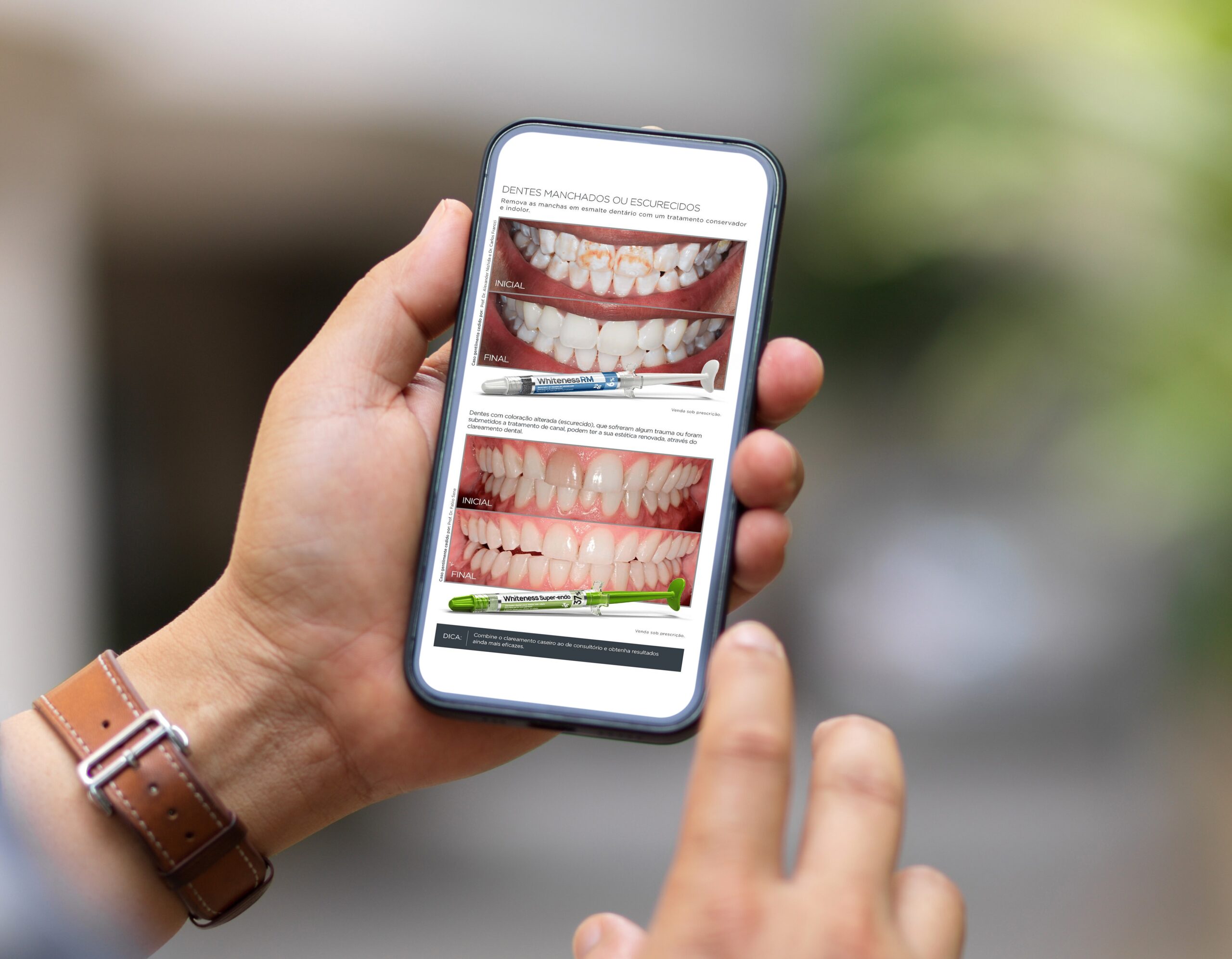 Kit de consultório – FGM Dental Group