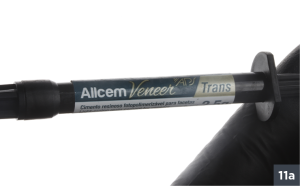 Allcem Veneer - Cimento Resinoso - FGM Dental Group