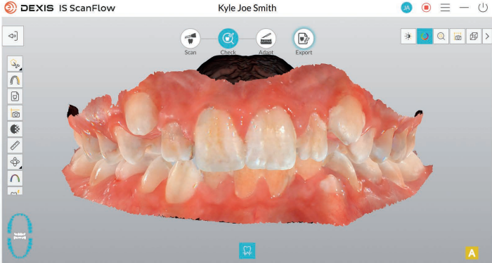 Arcsys + Dexis: a união entre duas soluções inteligentes - FGM Dental Group