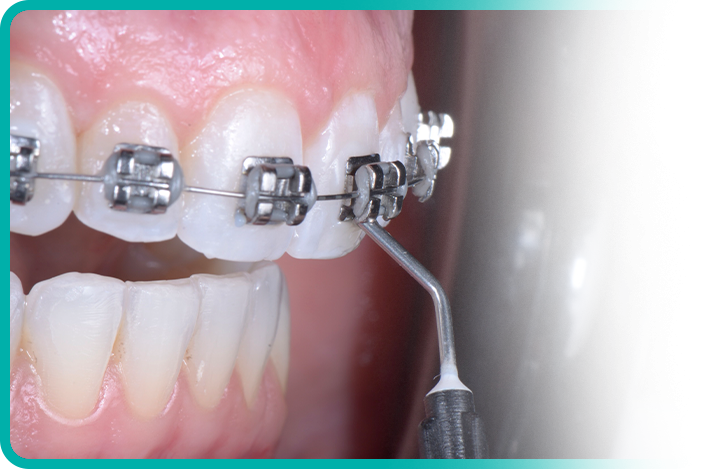 Ortho Line - FGM Dental Group