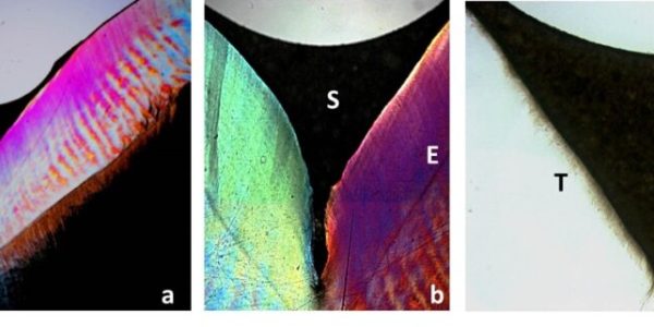 Protocolo clínico para aplicação do selante de fóssulas e fissuras ...